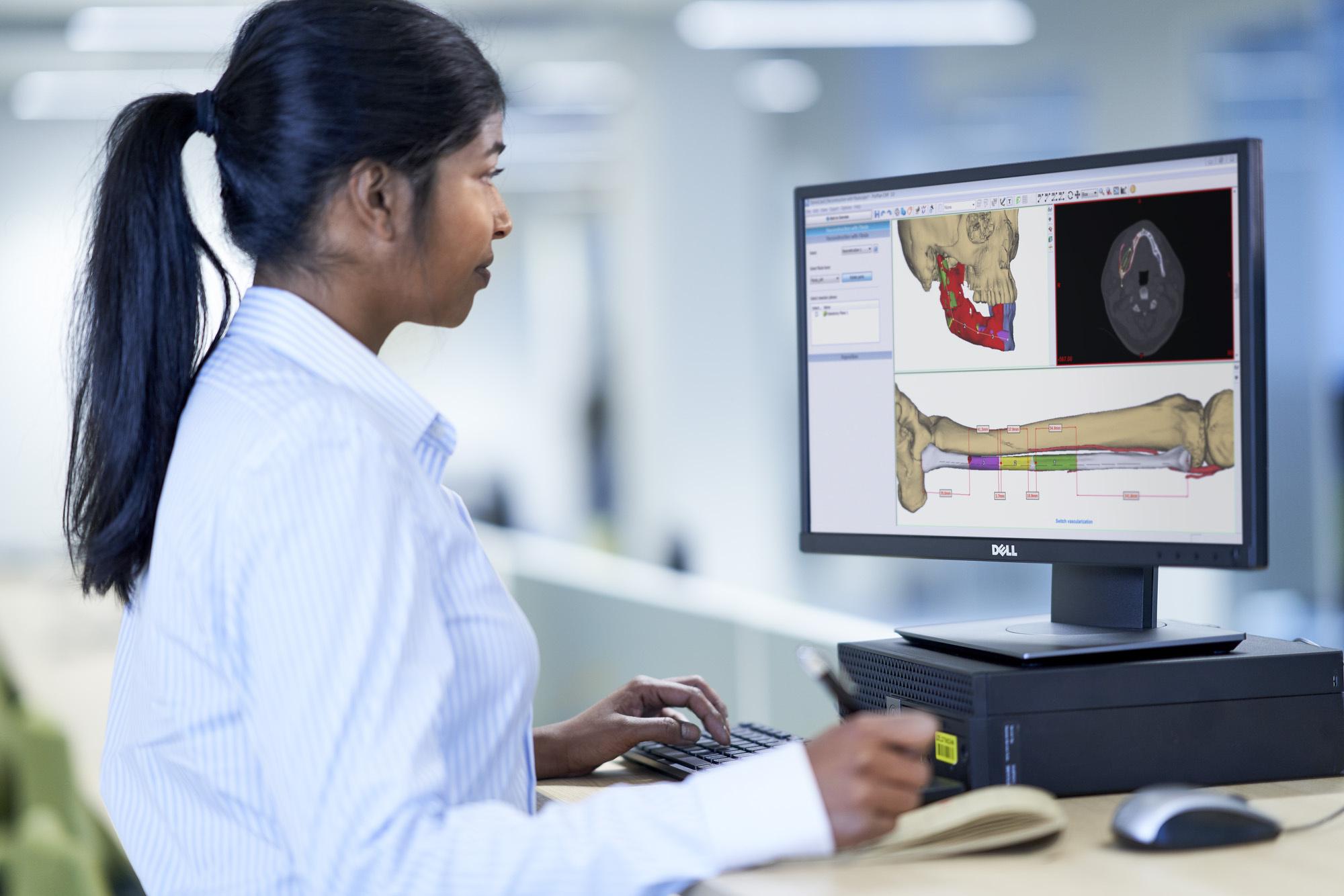 MATERIALISE: Creating Business Impact with Additive Technology - MIDA ...
